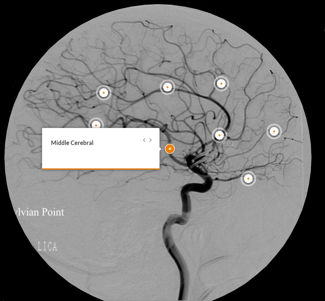 Neurovascular Essentials Software